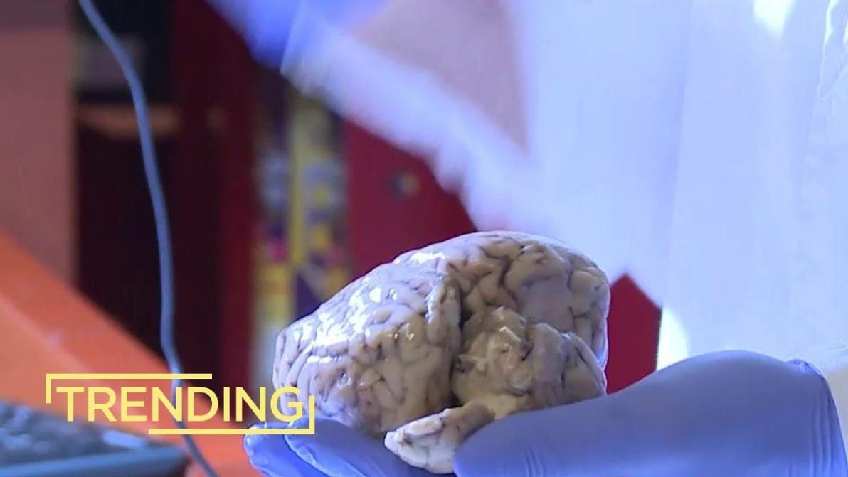 Brain Simulation Section: Educational Brain Atlas released on Human Brain Project Collab platform