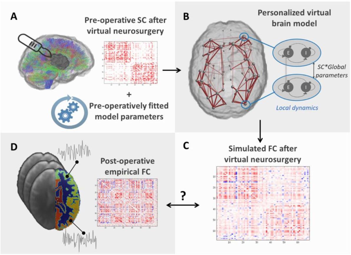 Brain Simulation Section: The Virtual Brain used in new study on modeling surgery outcomes for ...